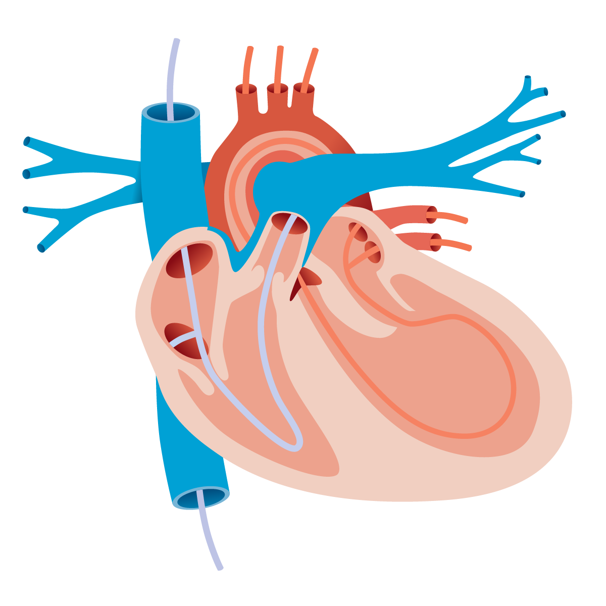 Heart disease | Types | Heart failure – Itsconnected.ca