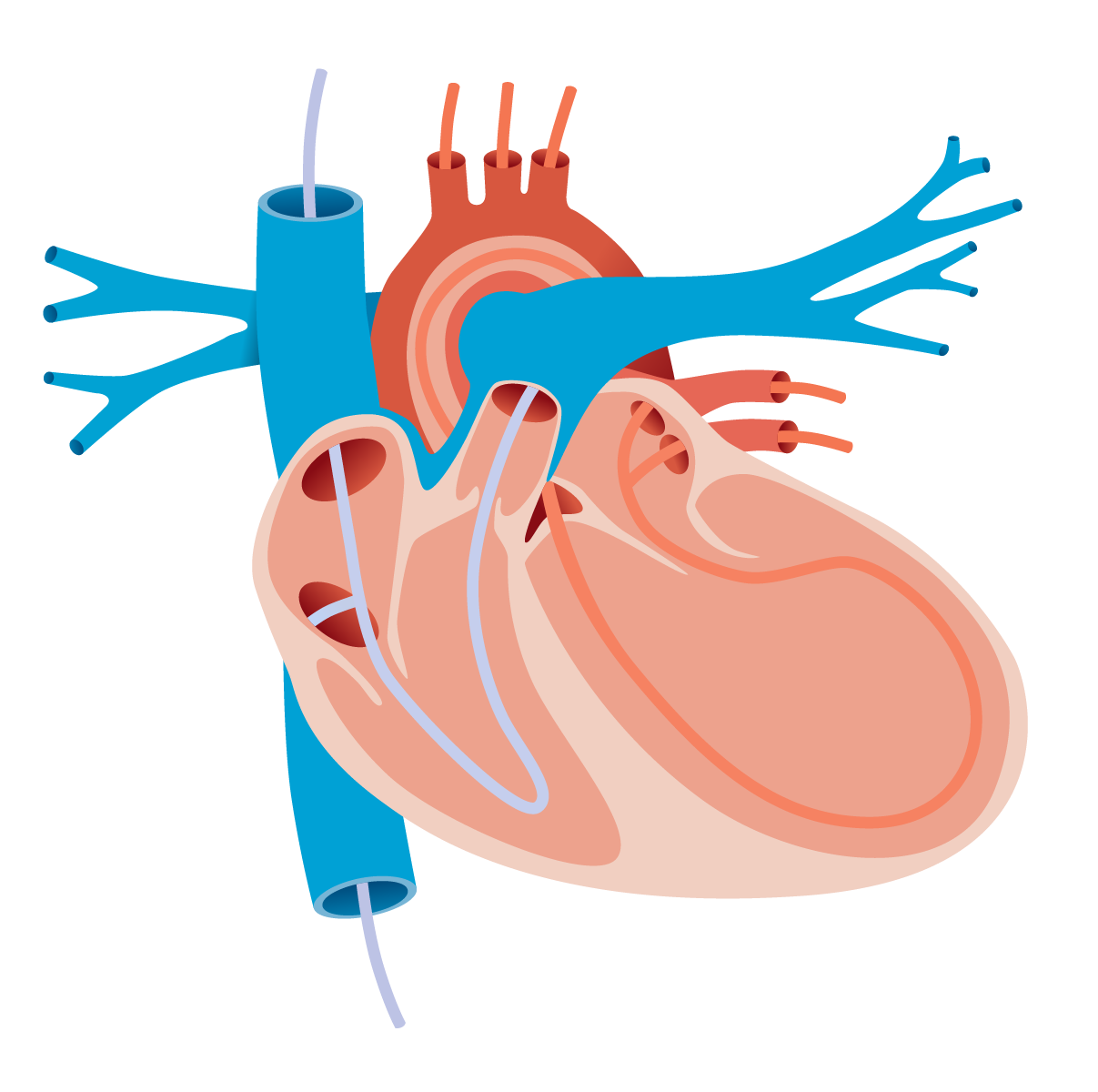 Heart disease | Types | Heart failure – Itsconnected.ca